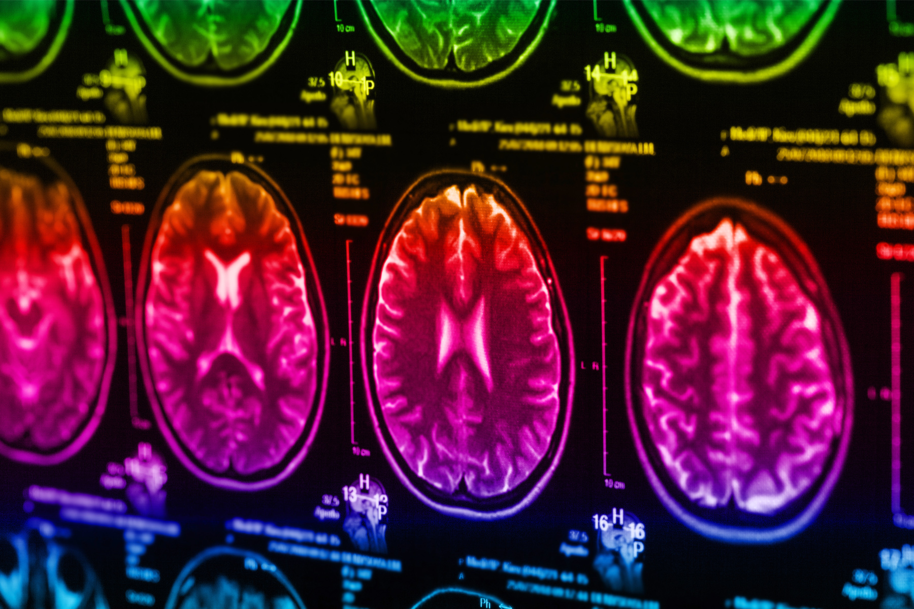 At Parkland Health, the End of Subjective Surgery - D Magazine