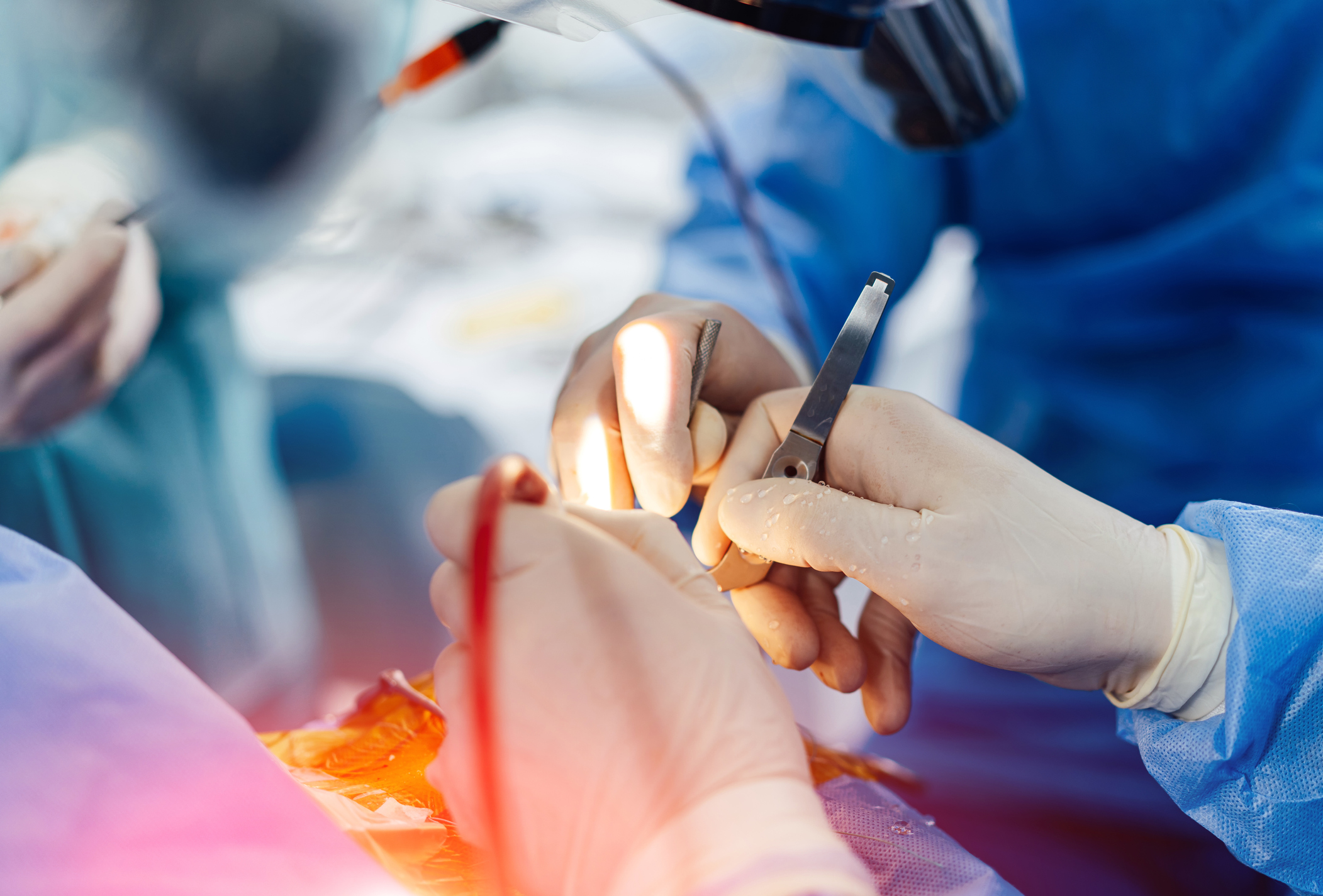 Keeping Brains Alive: Why UTSW Researchers Are Isolating the Organ From ...