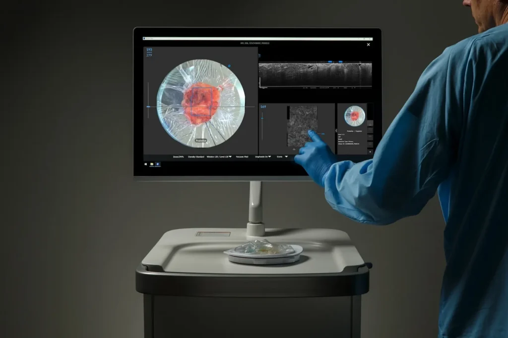 Perimeter Medical Receives FDA Approval for AI Imaging Device for ...